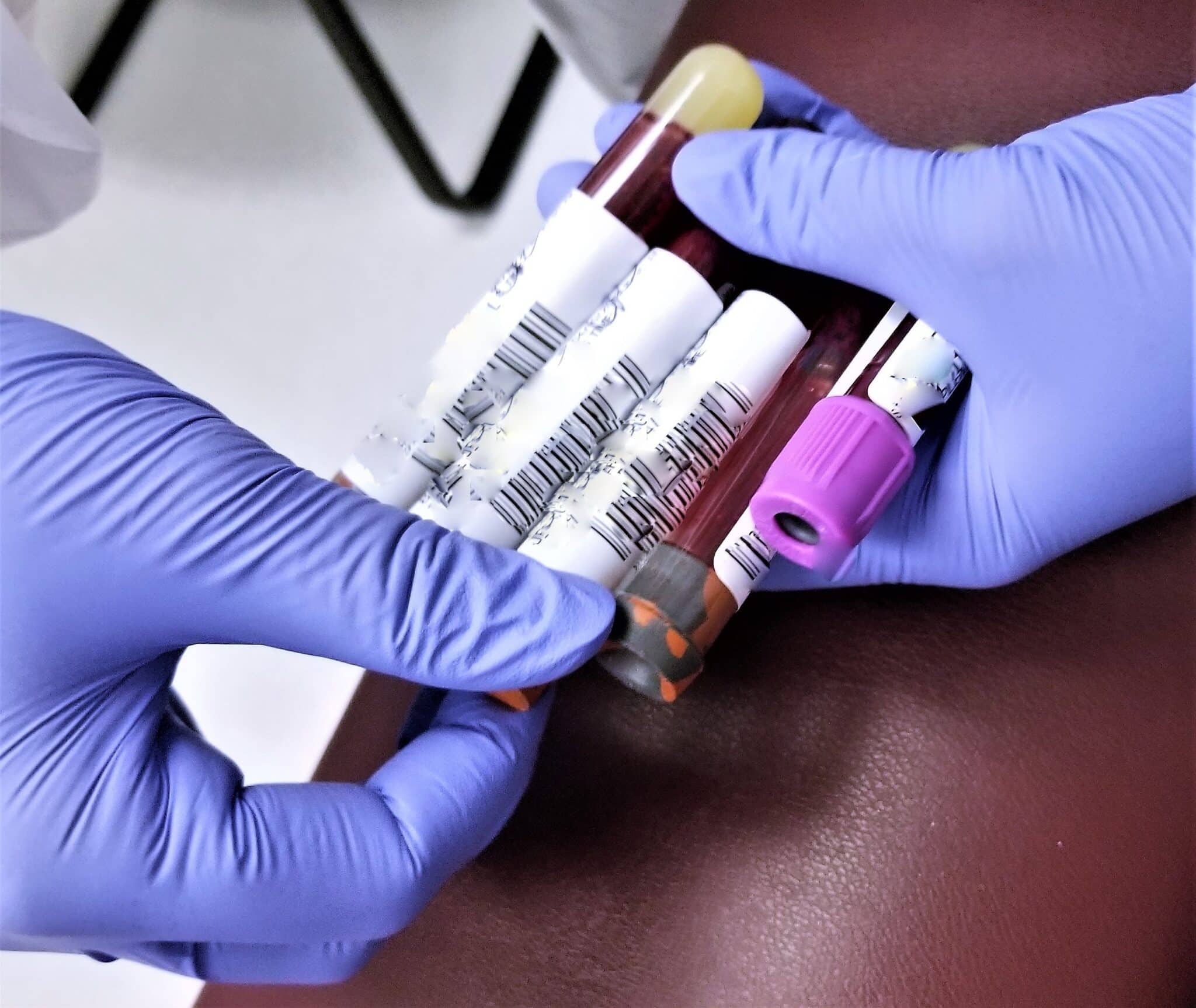 Phlebotomist Lab Technician | How Are They Different From Lab Techs?