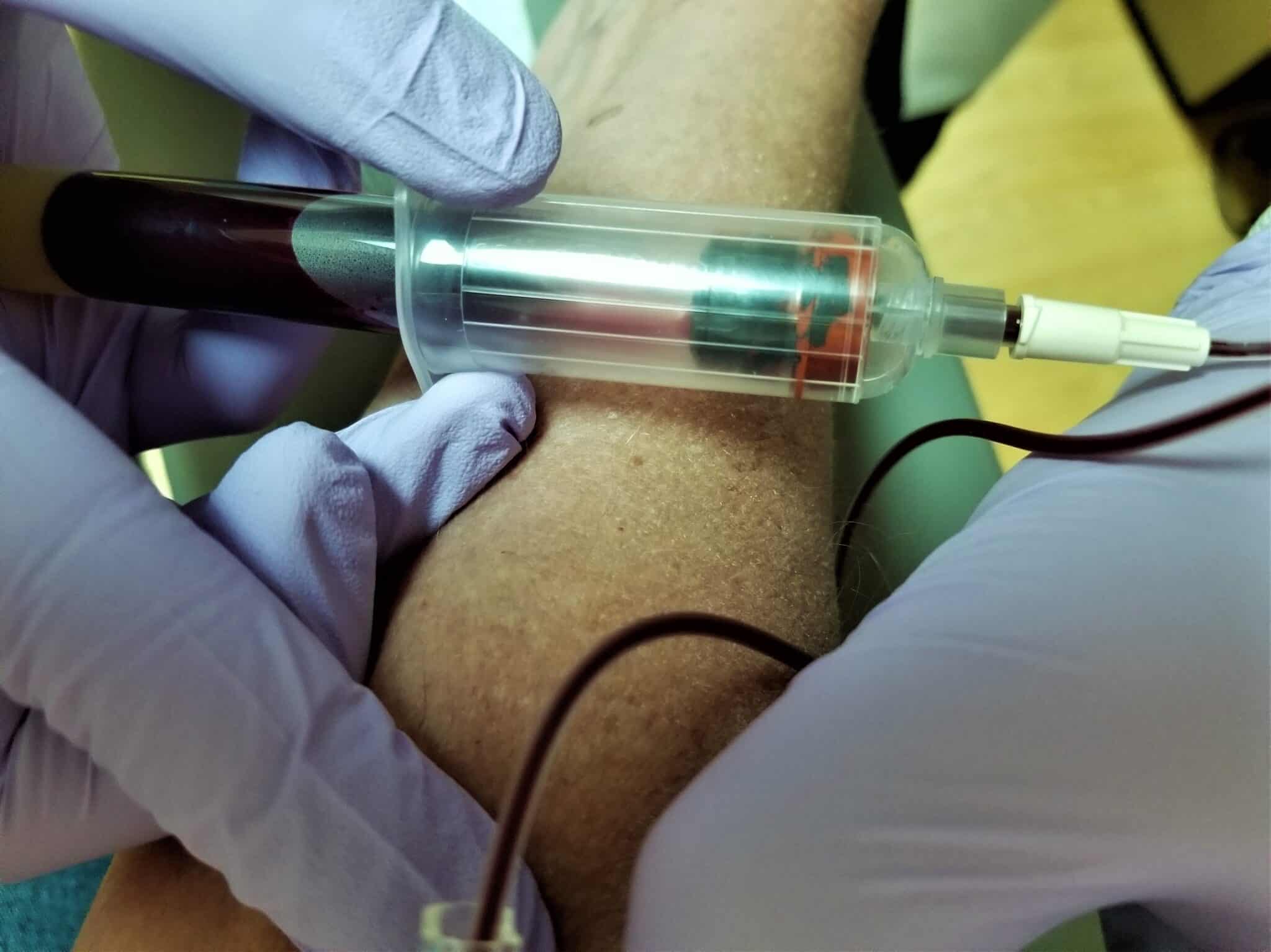 Therapeutic Phlebotomy | What is It, and How To Get It In 2024?