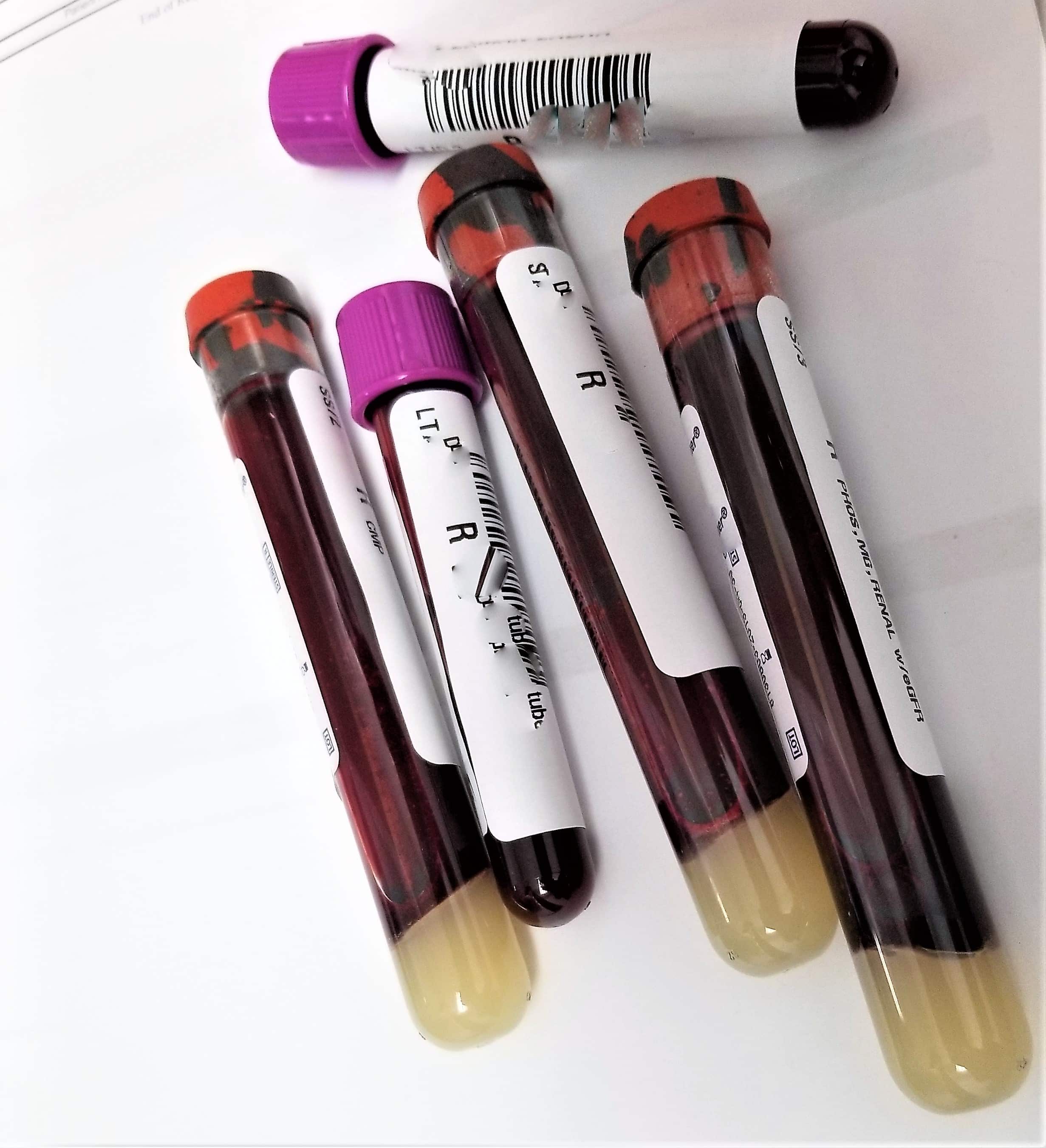 Phlebotomist Cover Letter | How To Stand Out From The Crowd